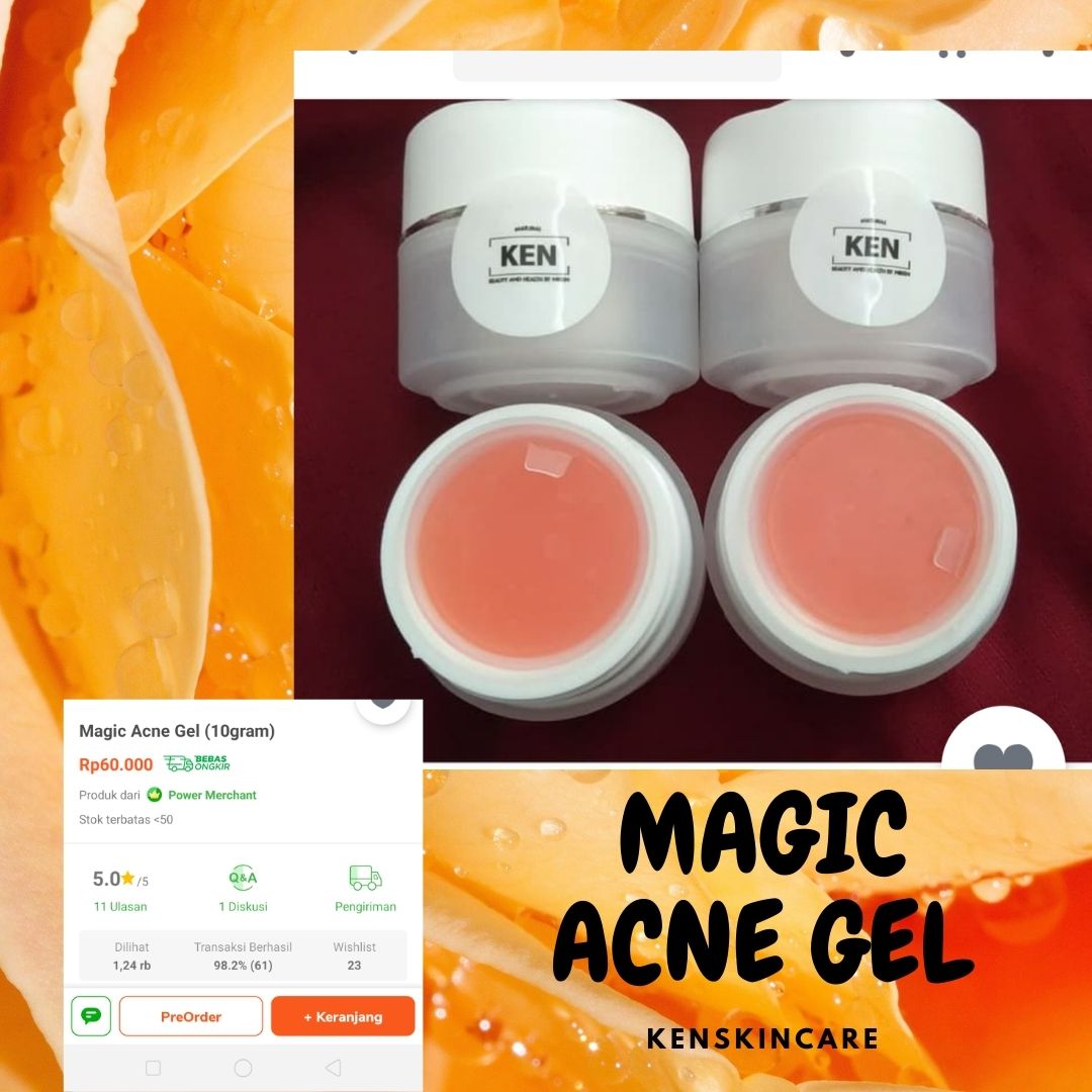 Jual Magic Acne Gel
